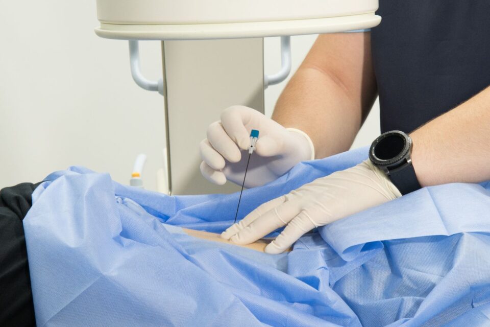 Sacroiliac Joint Steroid Injection in Denver - MD Pain