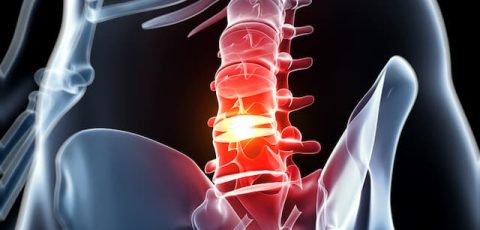 VIA Disc NP in Denver - MD Pain