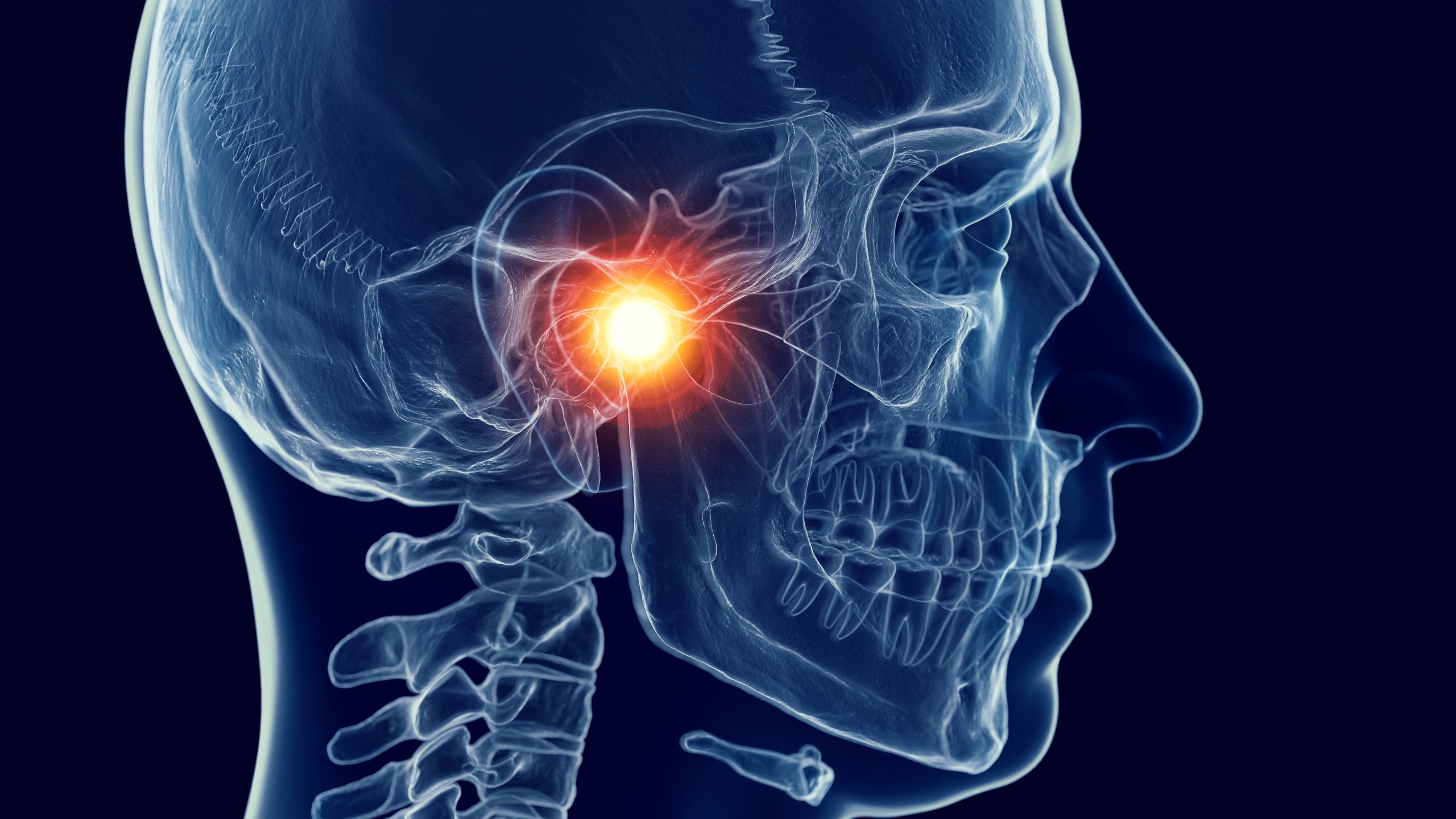 TMJ Specialist Denver - MD Pain